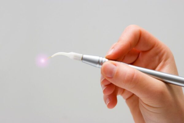 Benefits of Laser Therapy in Dental Hygiene | Sala Family Dentistry ...